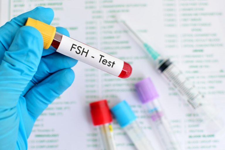 A Comprehensive Overview Of The Follicle Stimulating Hormone Fsh Test